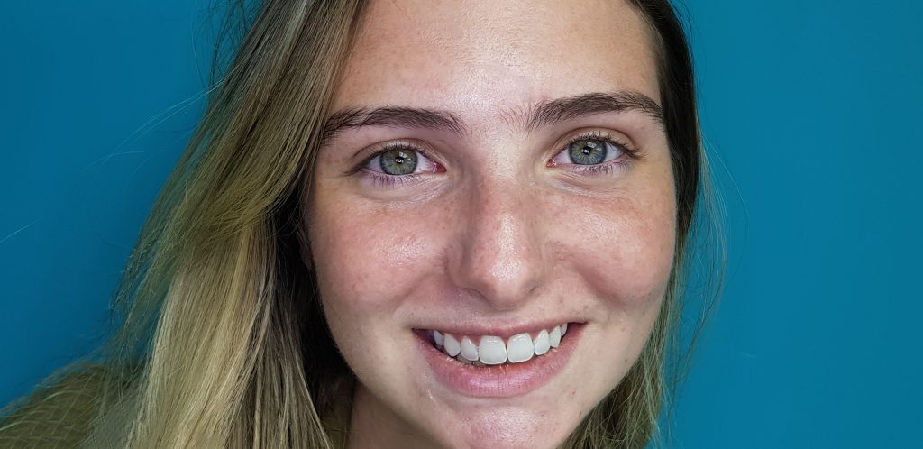 Teeth Whitening - Dr. Gilad Fiskus